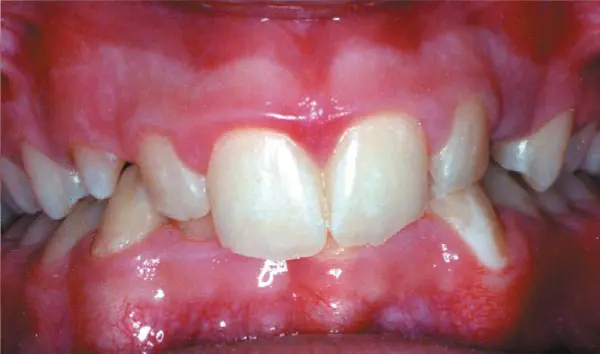 About Orthodontics - Wired Orthodontics